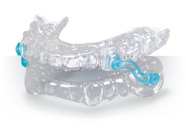kisspng-mandibular-advancement-splint-snoring-sleep-apnea ...
